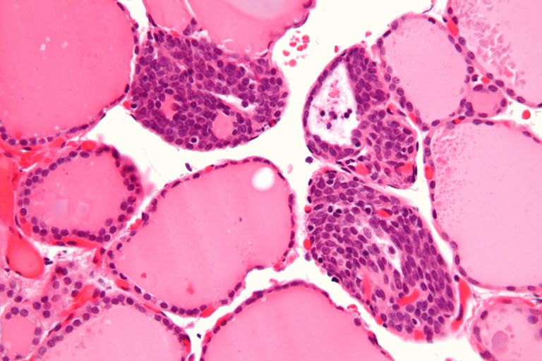 Researchers Engineer New Thyroid Cells | Chobanian & Avedisian School ...