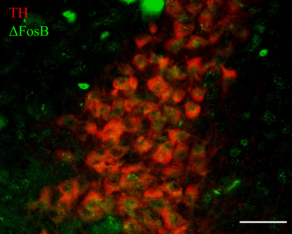Study Finds Alpha-2 Receptor Drugs Reduce Heavy Alcohol Drinking ...