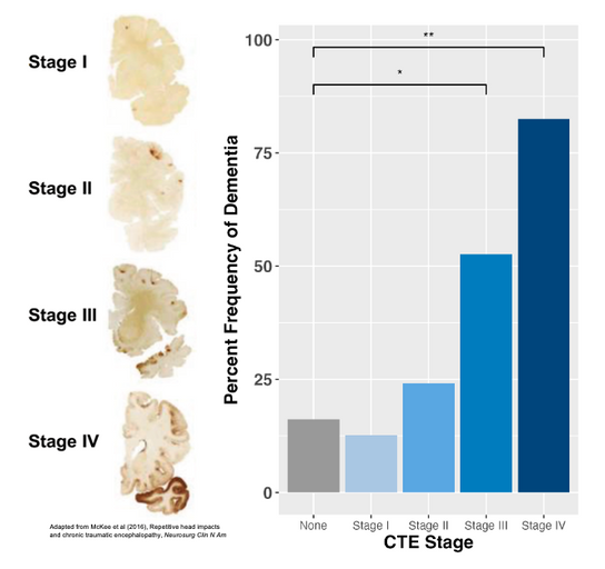 Study Identifies CTE as Cause of Dementia | Chobanian & Avedisian ...