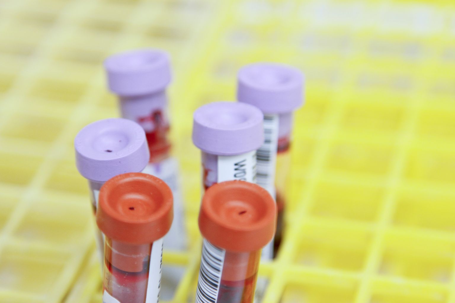 Researchers Identify Bile Acid and Steroid Signatures Tied to Extreme ...
