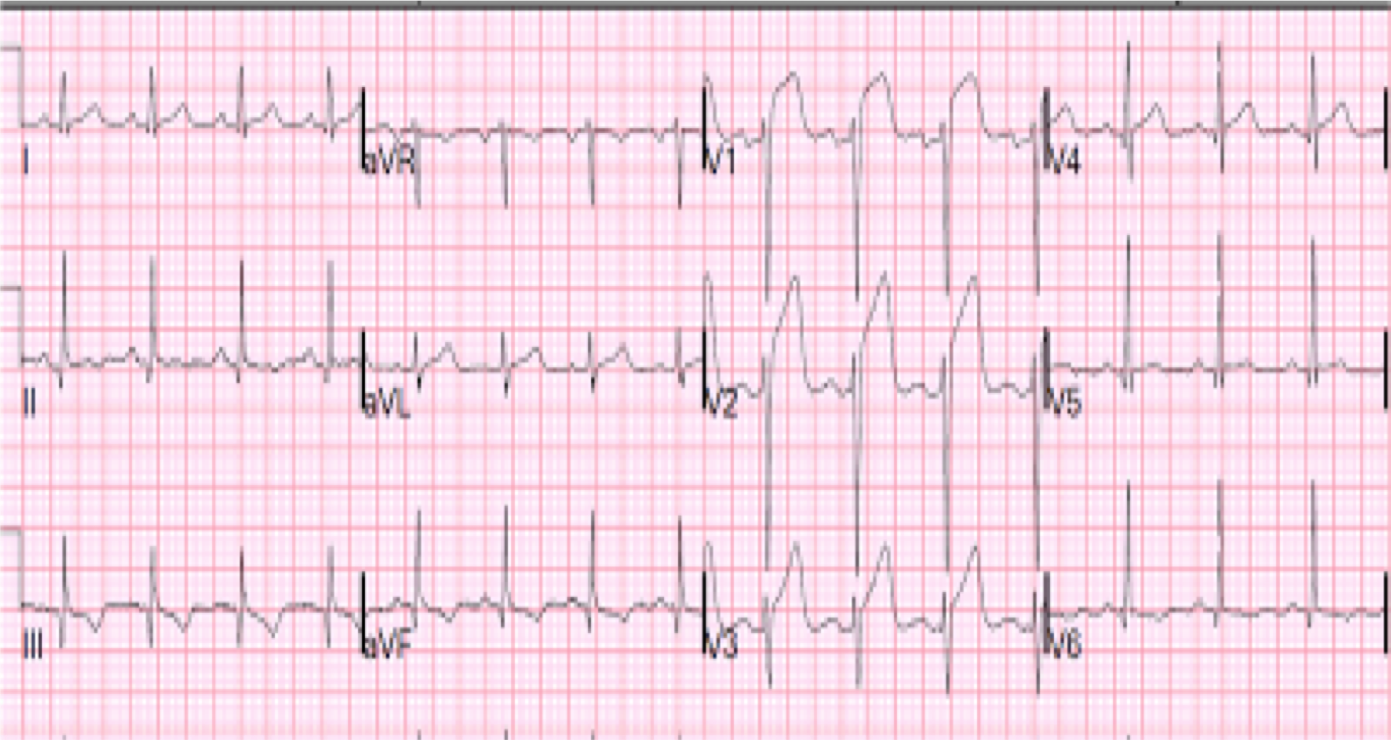 USOM III Case 1 | Emergency Medicine