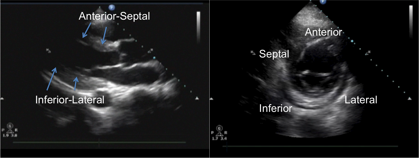 USOM III Case 1 | Emergency Medicine