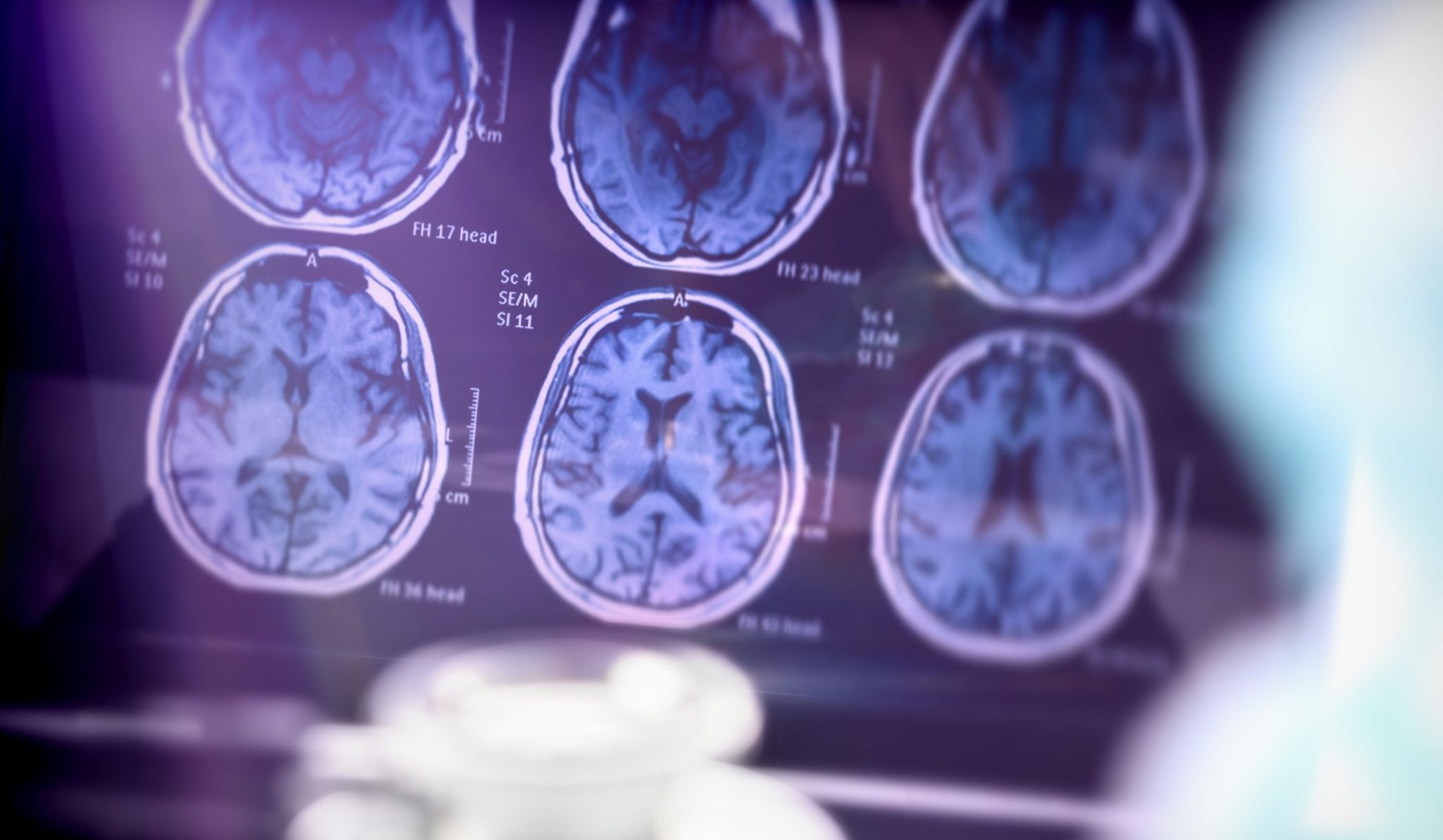 About Us | Framingham Heart Study Brain Aging Program