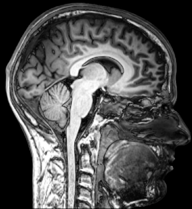 Digital Data at Framingham Heart Study | Framingham Heart Study Brain Aging Program