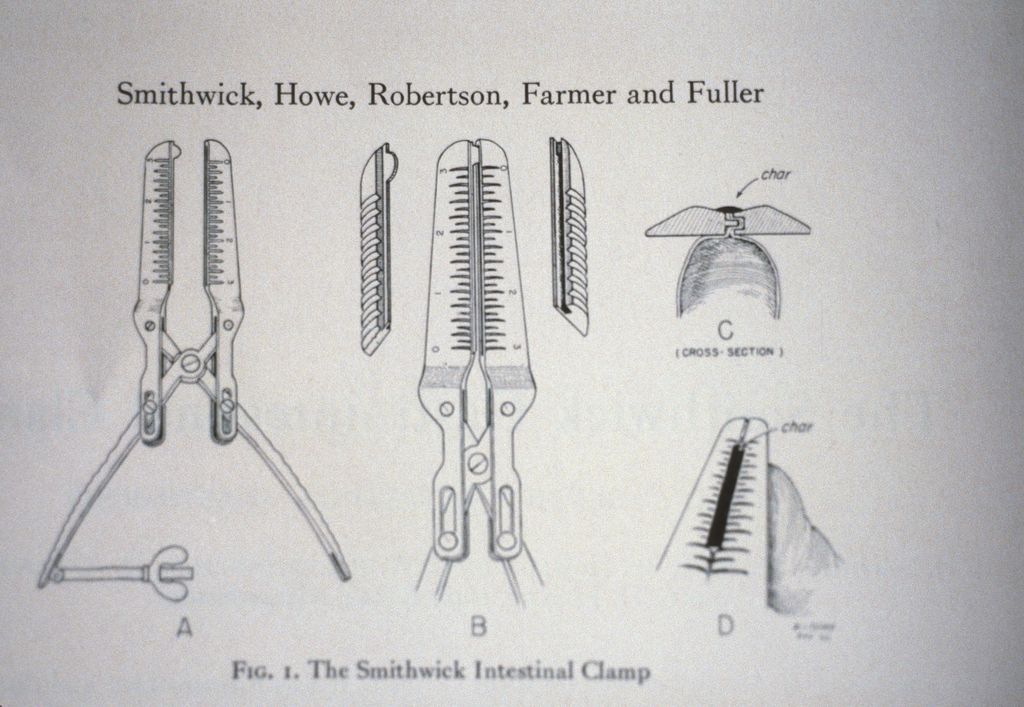 Smithwick Clamp 1 | Surgery